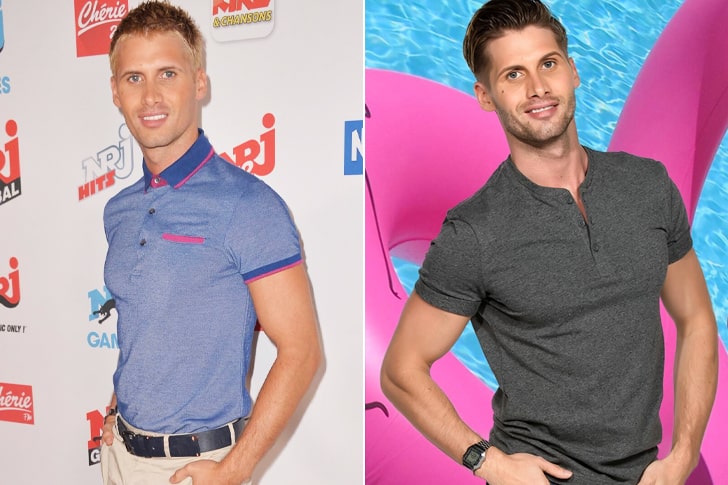 Ces célébrités françaises ont tous subit la chirurgie esthétique et ...